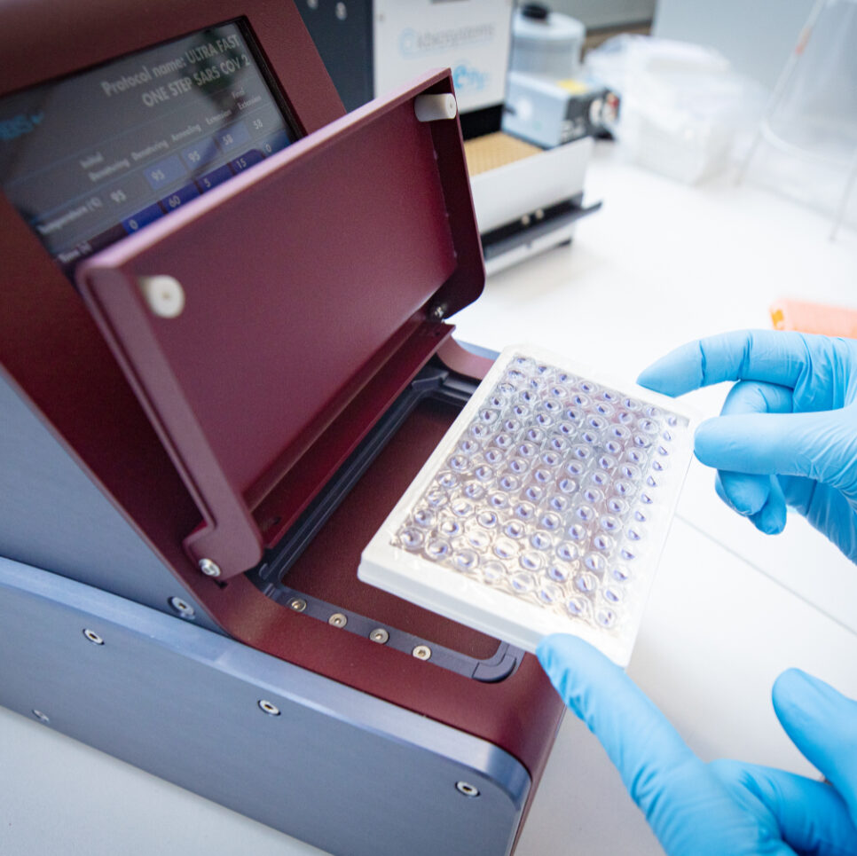 New method performs corona test ten times faster – Aktuell Uni Bielefeld